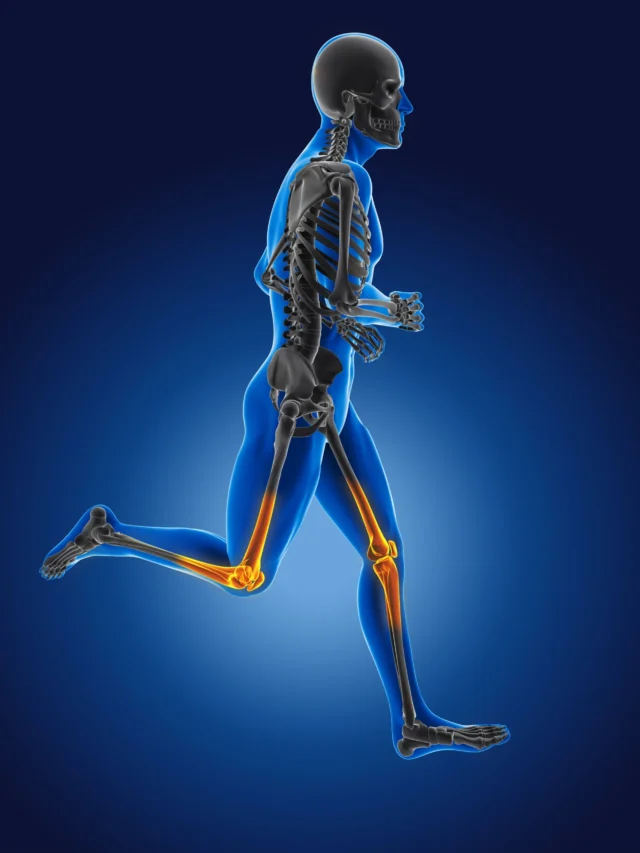 How to Improve Bone Health - Dr. Madan Mohan Reddy